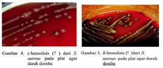 Analis Poenya Kendari: “ ISOLASI DAN IDENTIFIKASI BAKTERI ...