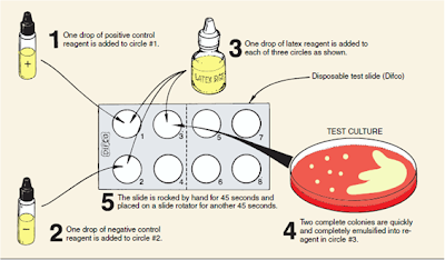 Antigen-Antibody reactions: Agglutination and types - microbeonline