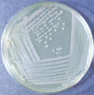Bacterial Culture Media: classification, types and uses