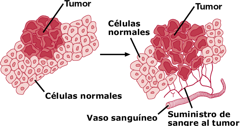 Porque un cancer: Que es cancer
