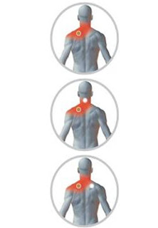 Patch for Health: Patching Instruction - Icewave