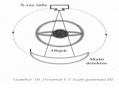 block note: CT-SCAN