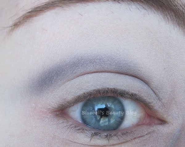 Diagram Of Collapsed Uterus