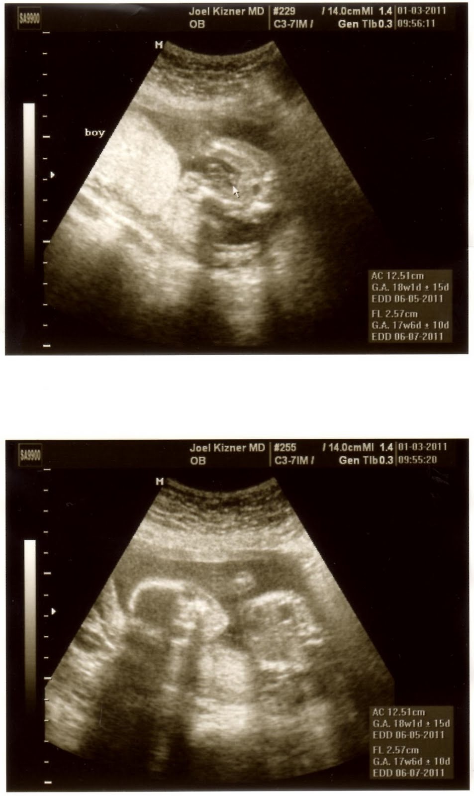 Growing Jacobsons: 17 week ultrasound/OB visit