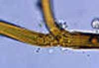 Algas: CLASIFICACION DE LAS ALGAS : Algas azul-verdes ( Div. Cyanophyta ...