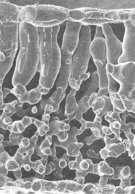 BIOLOGY ORDINARY LEVEL NOTES: PLANT NUTRITION PART 1:THE LEAF