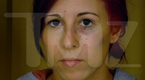 FUR IMMER 89: Fotos de Alex Welch con los golpes de Demi Lovato