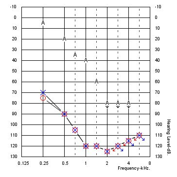 A deaf dude's life: All my audiograms thus far with my comments on them!