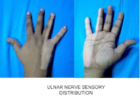 NEUROLOGY INVESTIGATIONS: ULNAR NERVE ANATOMY