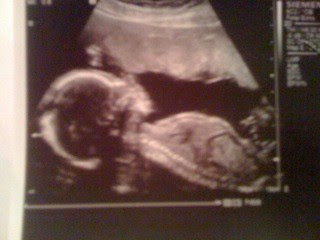 Big Trouble: 19 week ultrasound today- Baby Z