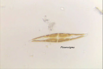 Encyclopedian Dictionary ( Pleurosigma ): Pleurosigma (Diatom)