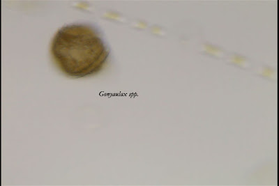 Encyclopedian Dictionary ( Gonyaulax ): Gonyaulax (Dinoflagellate) #006 ...