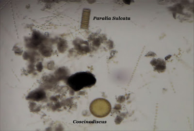 Encyclopedian Dictionary ( Coscinodiscus - Diatom ): Coscinodiscus ...