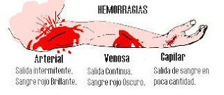 PRIMEROS AUXILIOS: HEMORRAGIAS