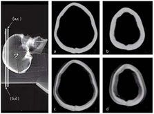 physics: ARTIFACTS IN SPIRAL CT