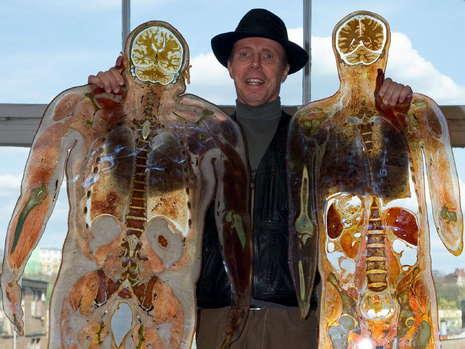 Gunther von Hagens Body Worlds Exhibit on Pinterest | Exhibitions ...