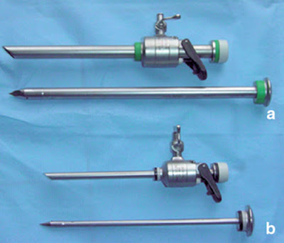 chirurgie coelioscopique