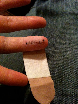 Short 'n Simple: Stitches