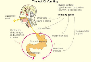 Juwita Blog: Health Tips Facts – Vomiting Causes,Cures,Effects,Home ...