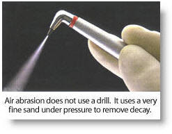 ONLINE DENTISTRY: AIR ABRASION - MINIMALLY INVASIVE TECHNIQUE