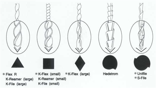 ONLINE DENTISTRY: cross section of hand instruments in endodontics