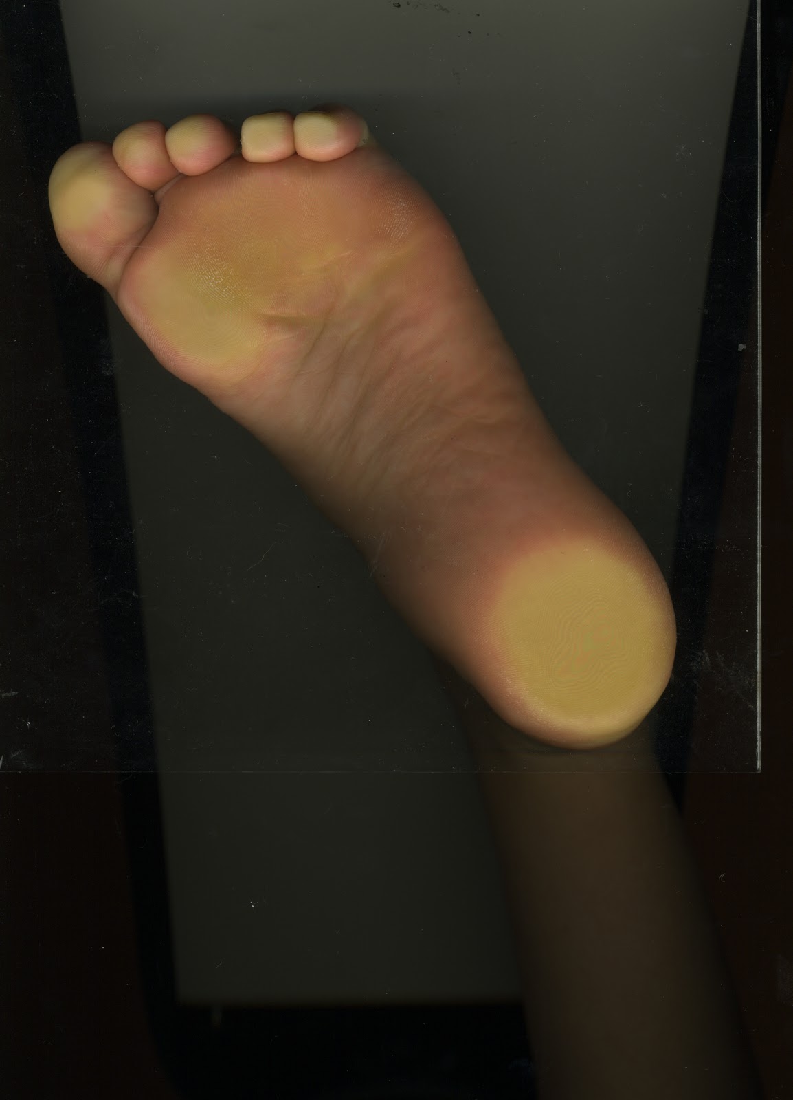 SkyGecko: Human/ Frog Hand,Feet Comparison