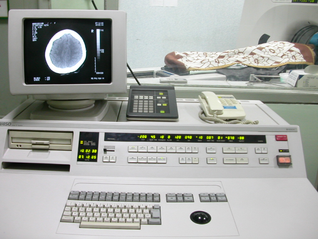 Babeh Edi: CT Scan Kepala