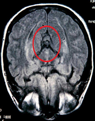 Nothing To Do With Arbroath: Woman finds Virgin Mary in her brain scan