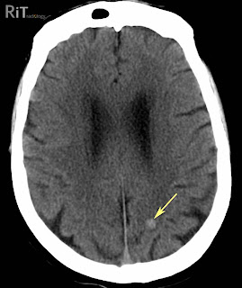 RiT radiology: August 2010