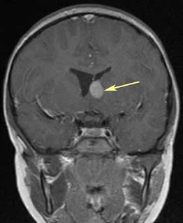 RiT radiology: March 2009