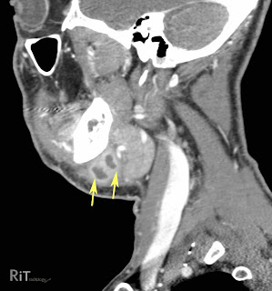RiT radiology: June 2009