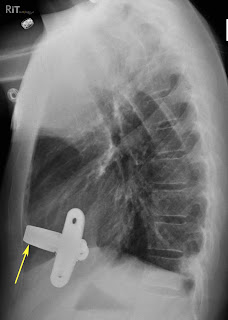 RiT radiology: October 2009