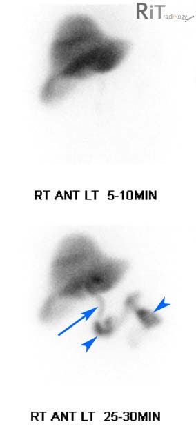 Understanding Hida Scan Results