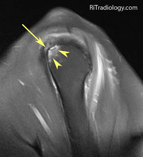 RiT radiology: March 2010