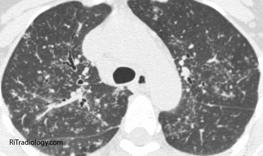 RiT radiology: October 2010