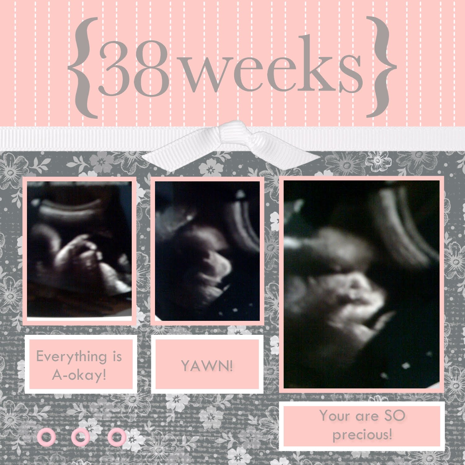 Letters to Stella Rose: 38 Week Ultrasound