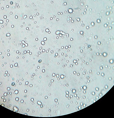 The Wonderful Microworld: Milk and the Curd (Fermented Milk) through ...