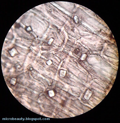 The Wonderful Microworld: Onion Skin Cells (Onion Scales) (Outer most ...