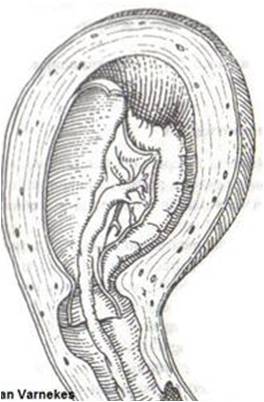 Porque nunca se deja de ser un Medicoblasto: Alumbramiento Fisiológico