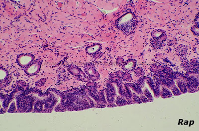 Macro y microfotografia: Microfotografía: Lengua de rana