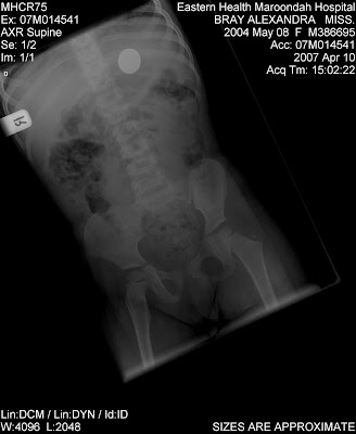 The Bray Clan!: The saga of the swallowed coin.....