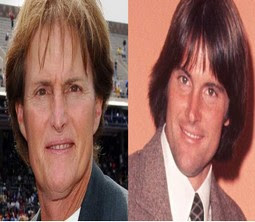 Bruce Jenner Plastic Surgery Before and After Picture, Photo | Blog Mad 123