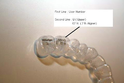 Invisalign Care: 1. How to take care of Invisalign Aligners