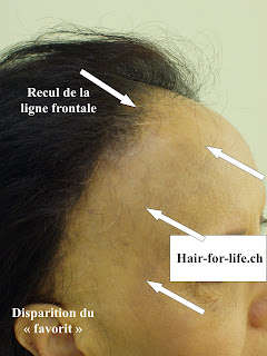 Hair for life: January 2008