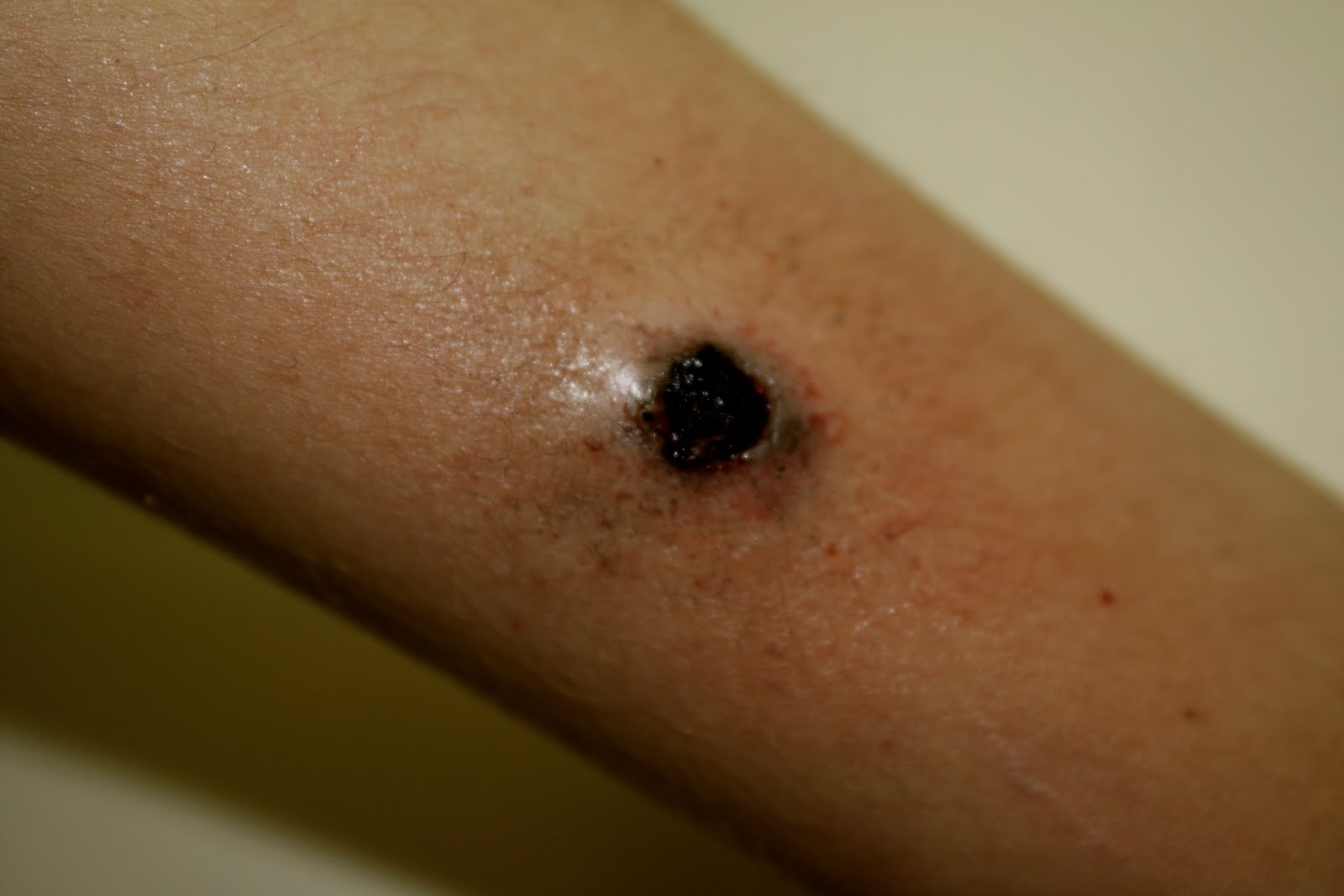 JeNelle Marie: the ins and outs of bullet wounds...