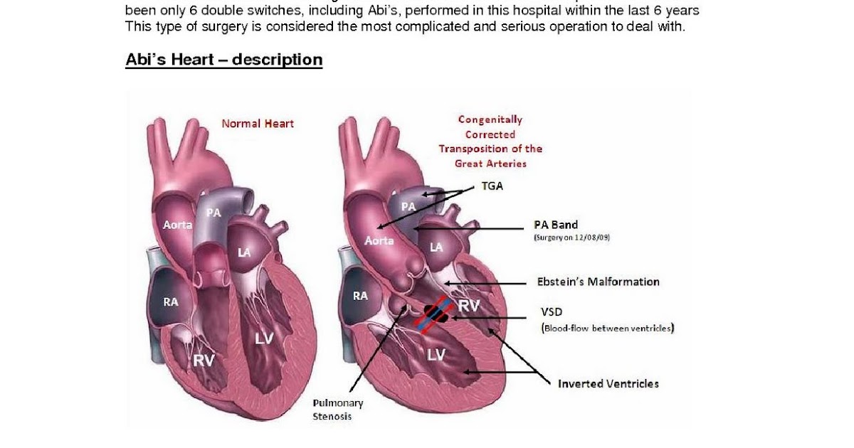 Double Switch Surgery - Part 1 : ~~~~~~ Abigail Maja