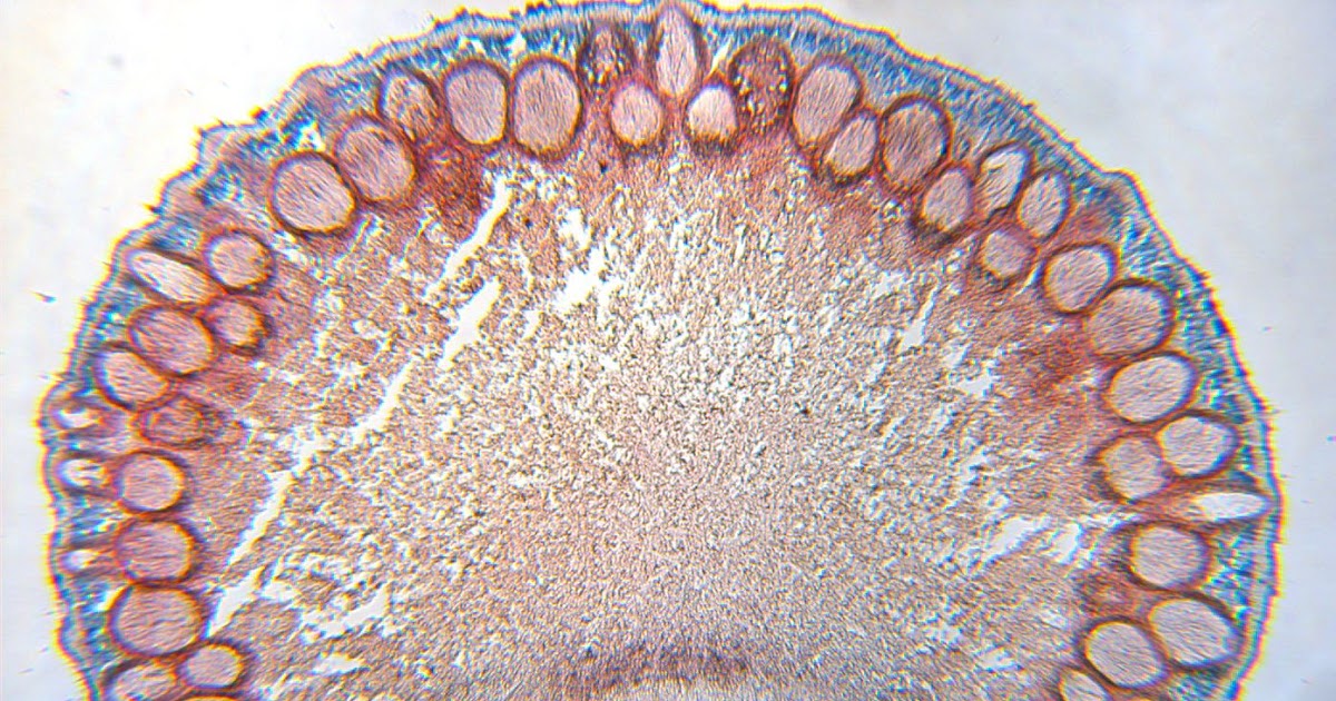 My Photography: Claviceps purpurea fruiting body sections