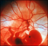 Baby Shafer: 11 Weeks Today...