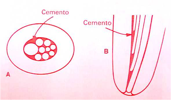 Periodoncia: CEMENTO RADICULAR
