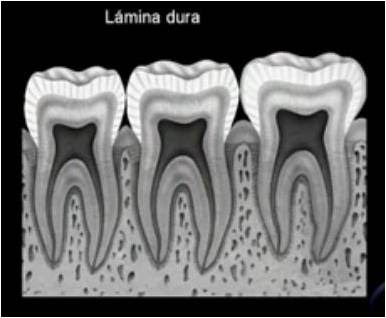 Periodoncia: HUESO ALVEOLAR
